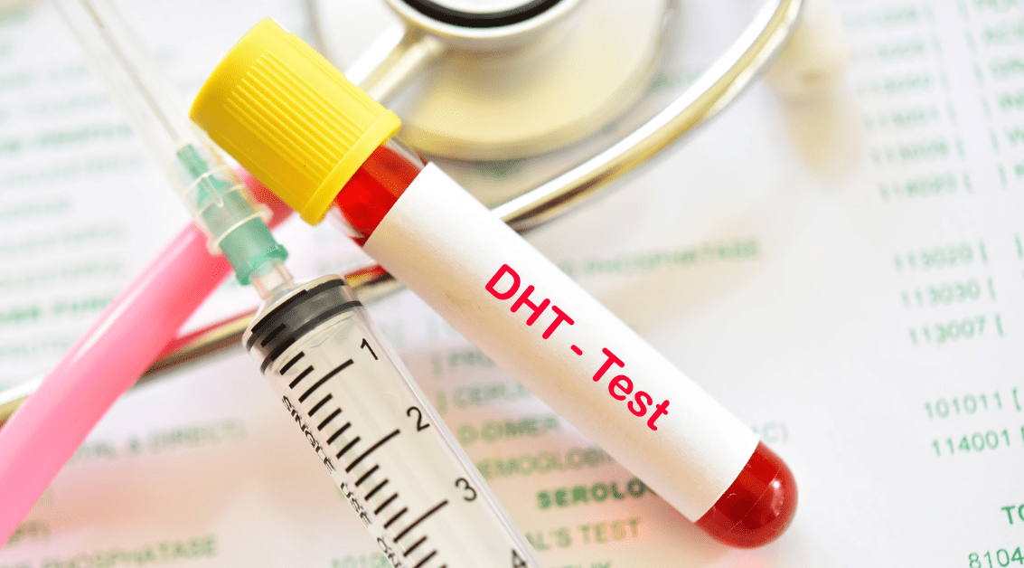 How to Stop DHT: A Comprehensive Guide – Follicle Booster